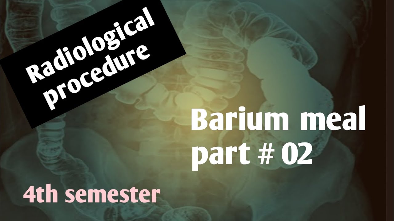 #barium meal//part # 02//images //duodenal caps//duodenal loops images ...
