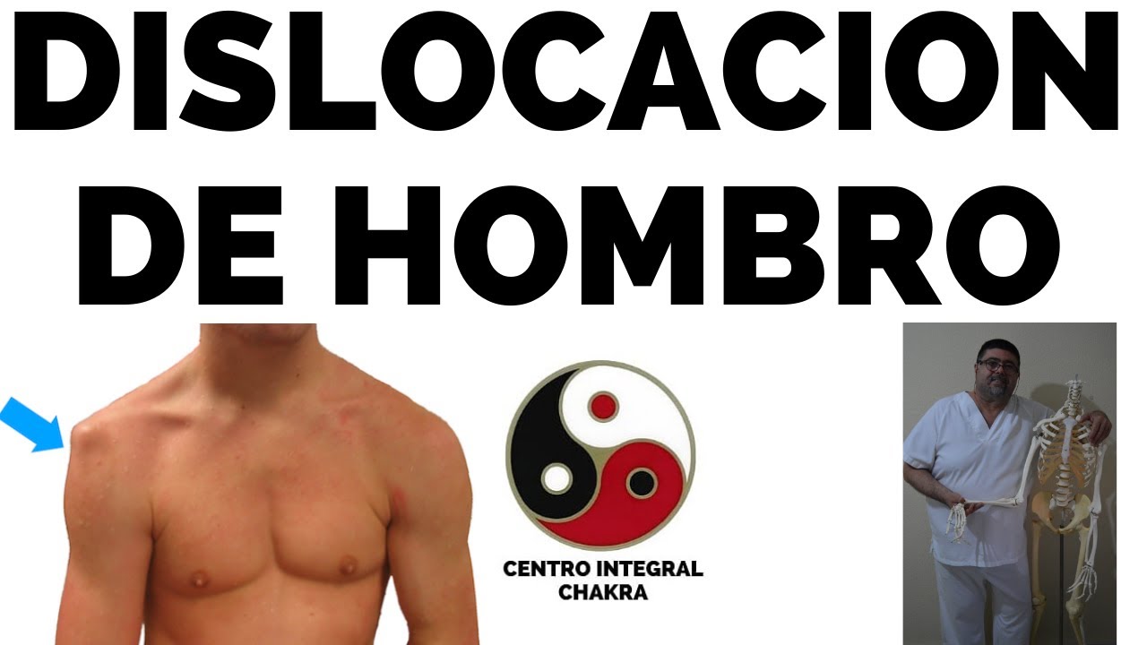 REDUCCIÓN LUXACIÓN ANTERIOR DEL HOMBRO DISLOCADO - YouTube