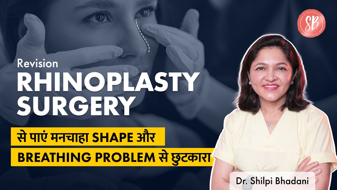 Everything you need to know about Revision Rhinoplasty | Dr. Shilpi ...