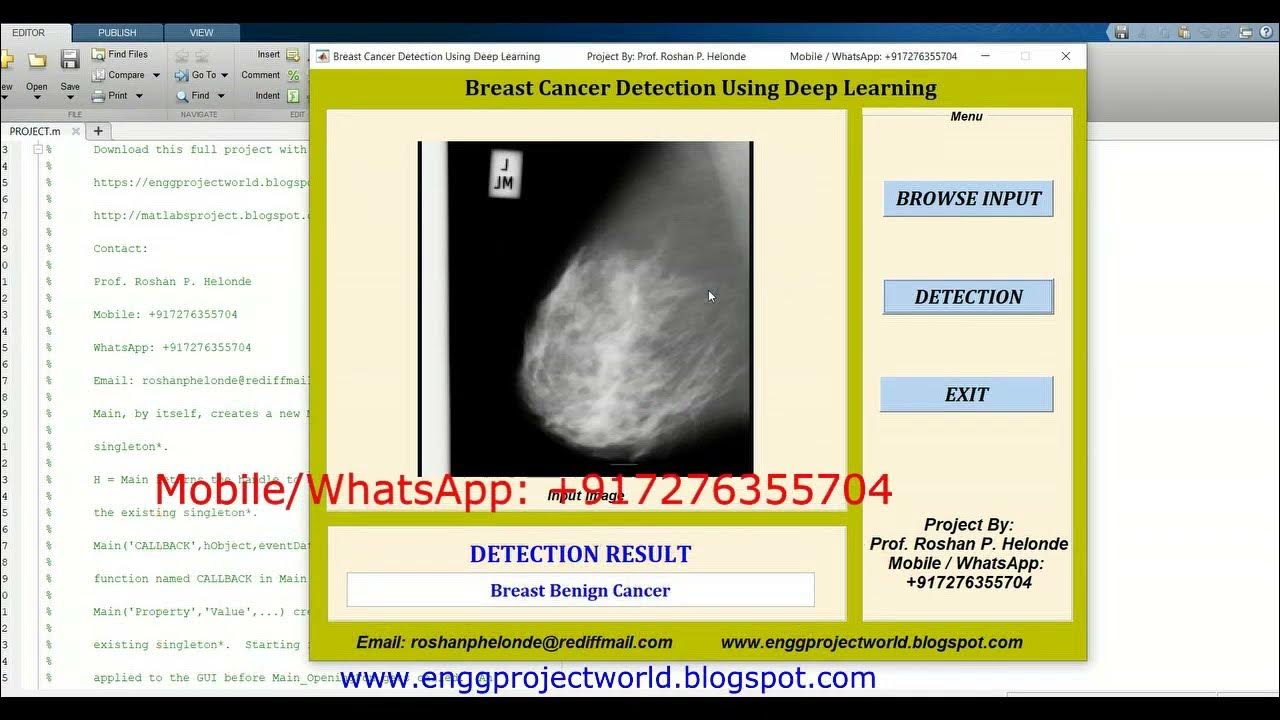 Breast Cancer Detection Using Deep Learning Matlab Project With Source Code Breast Cancer ...