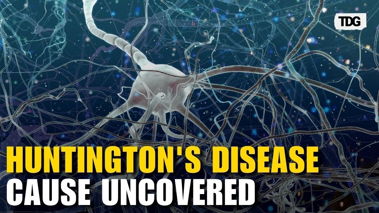 Scientists Uncover the Mystery Behind Huntington’s Disease in Major ...