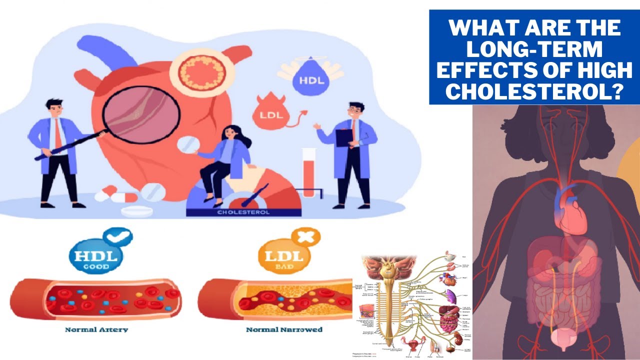 The Effects of High Cholesterol on the Body - What are the long-term ...