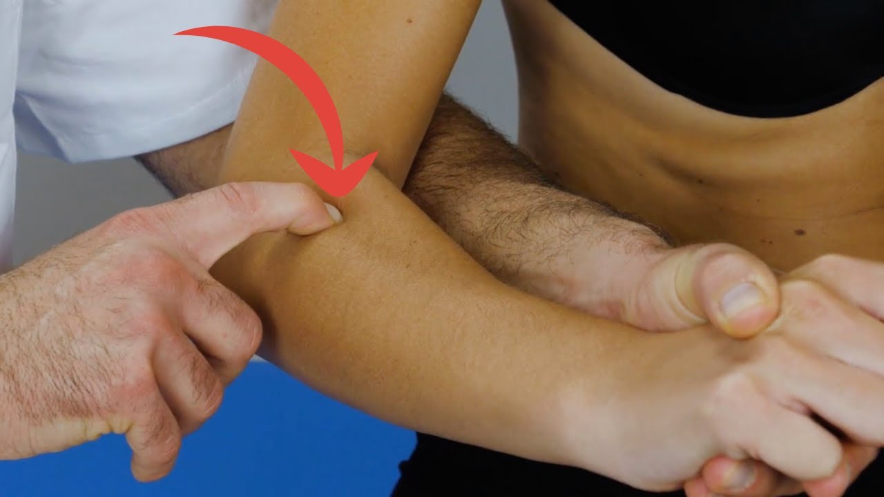 TRIGGER POINTS for EPICONDYLITIS - YouTube