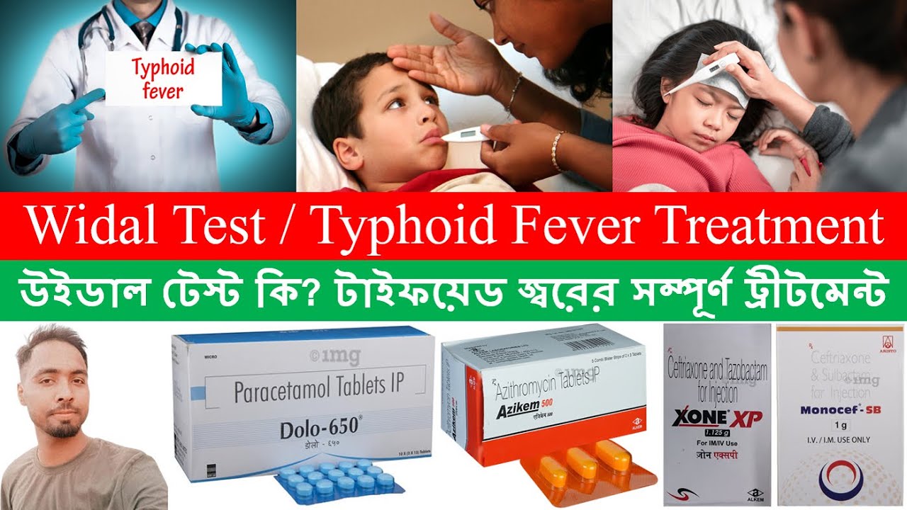 Typhoid Fever Treatment | Widal Test | Enteric Fever | Bong Pharma ...