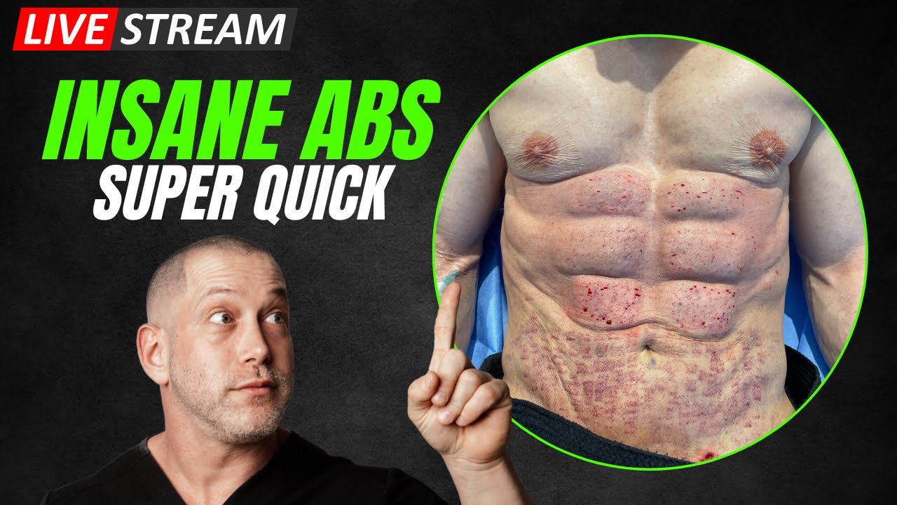 PLUMPING THOSE ABS WITH FILLERS - YouTube