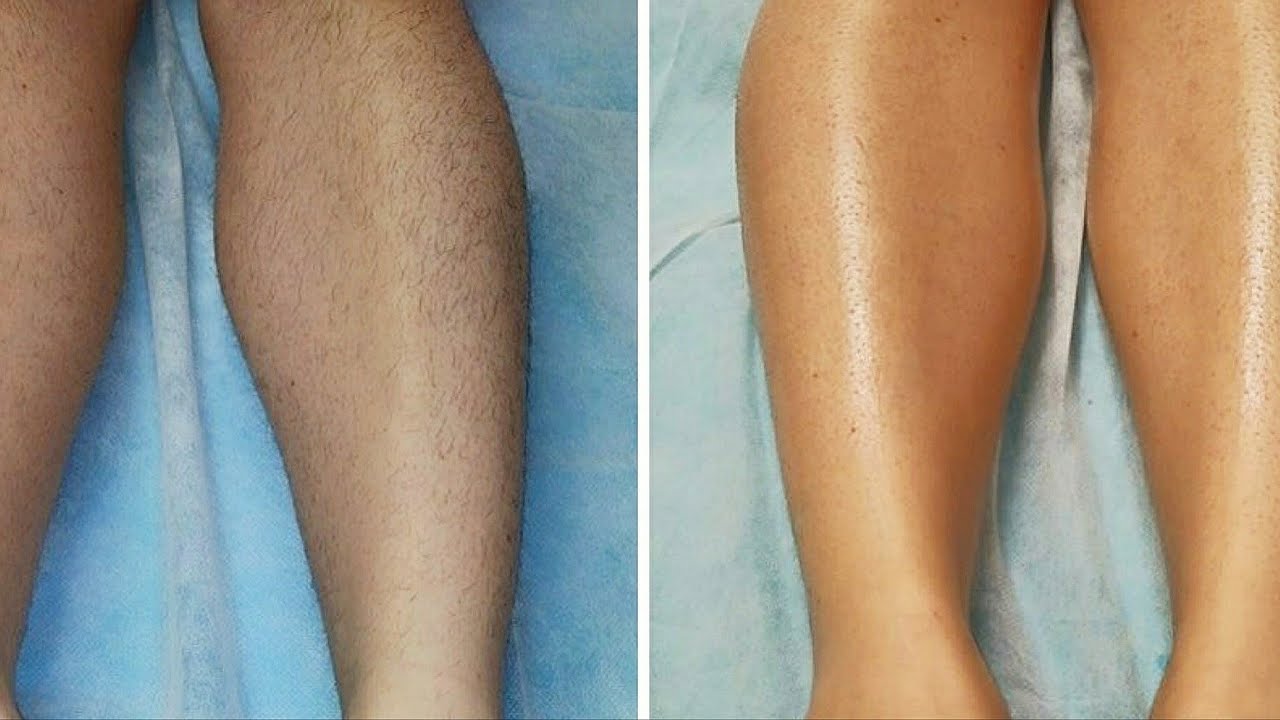 Full Leg Wax with Rica wax... जून जुलाई के मौसम में कैसे करें वैक्स ...