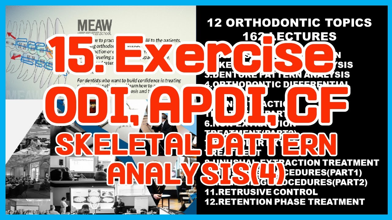 15.Exercise ODI APDI CF - SKELETAL PATTERN ANALYSIS(4) - YouTube