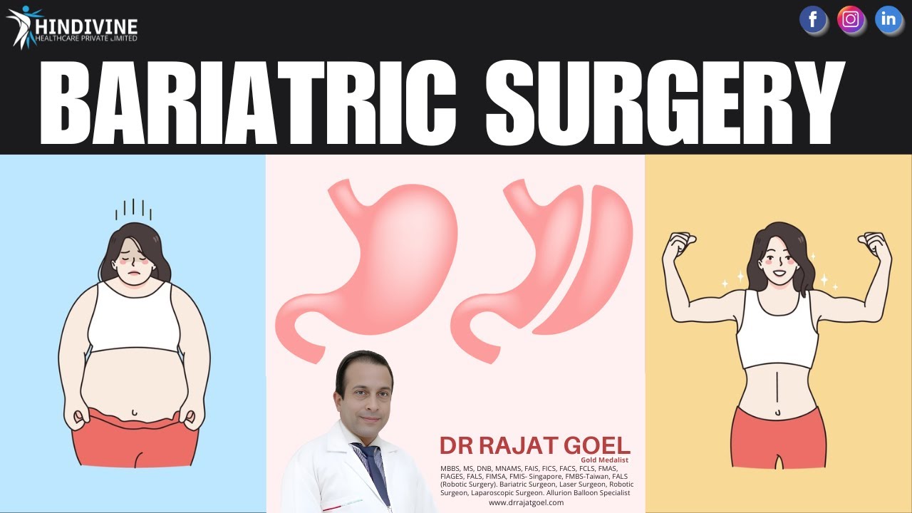 Bariatric Surgery Procedures Explained: Gastric Bypass, Sleeve, and ...