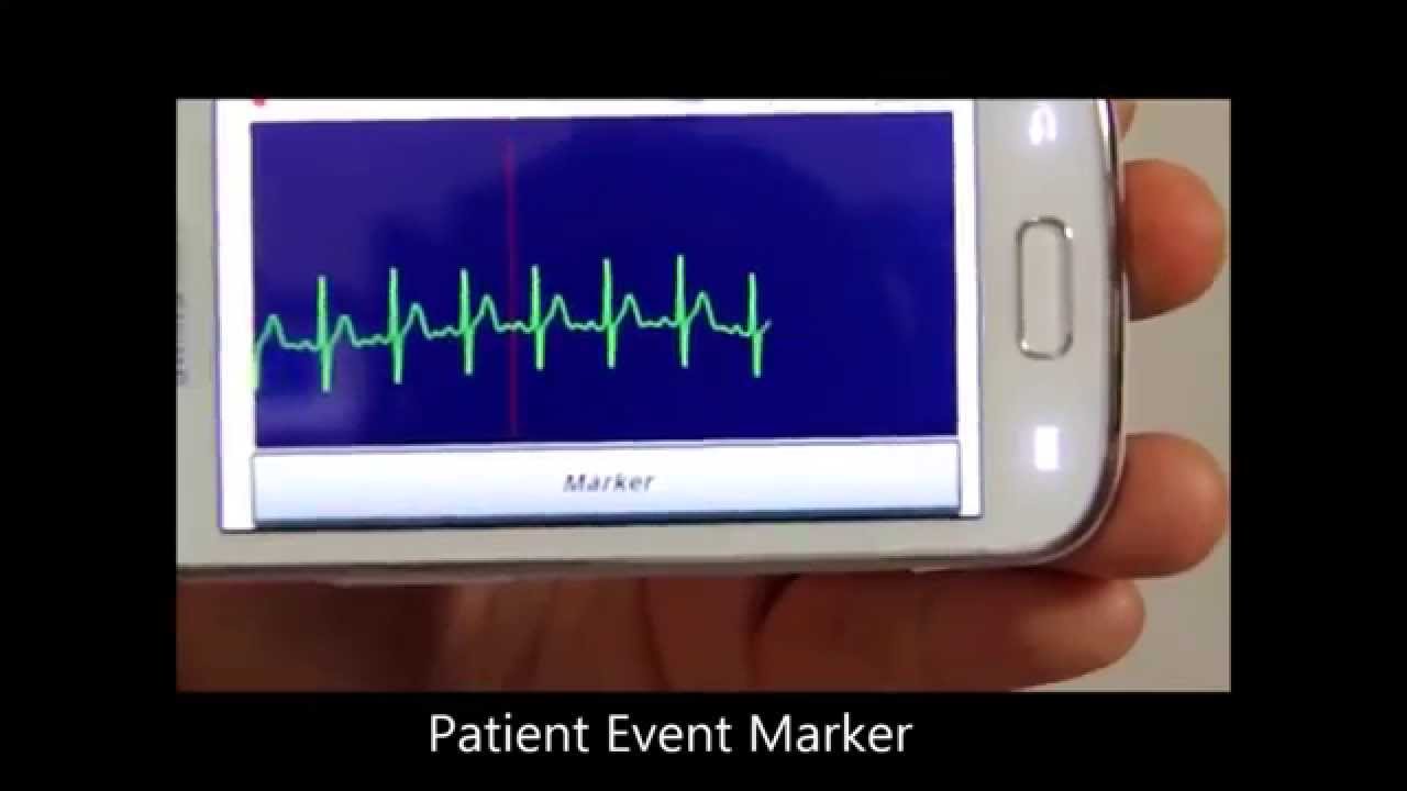 Revolutionary Spyder Continuous ECG monitoring System, www.mcg.hk - YouTube