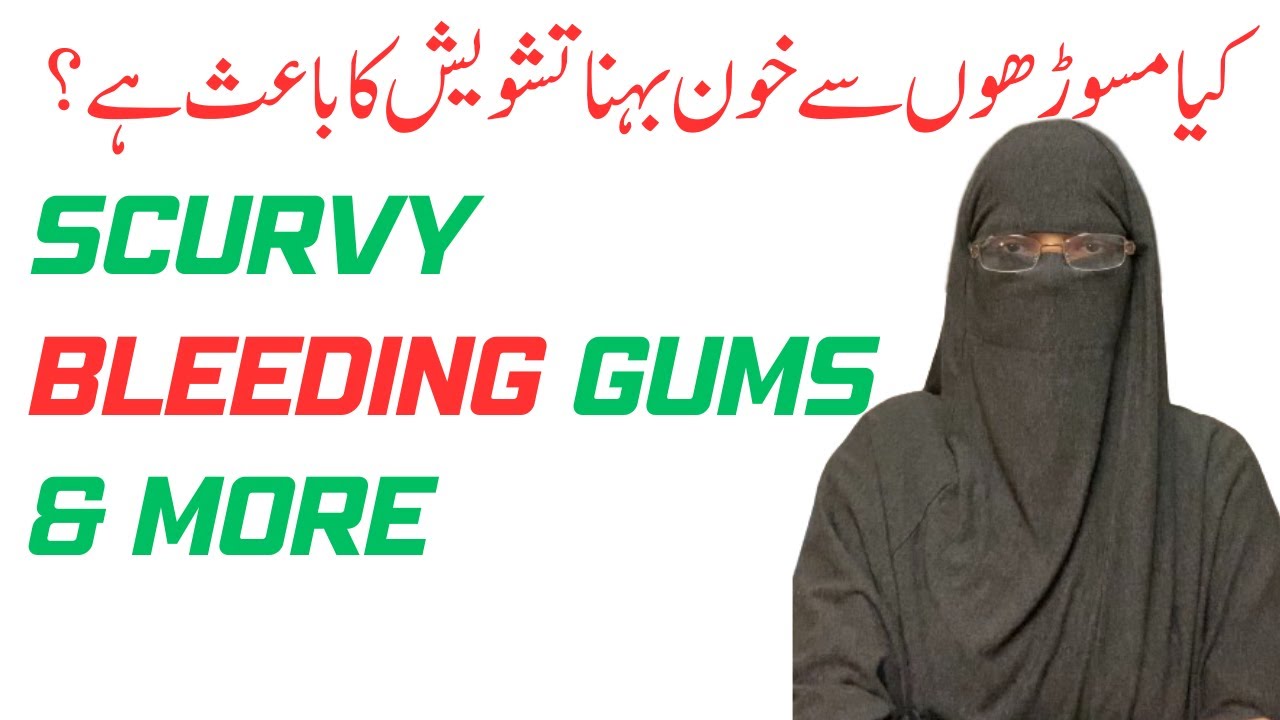 Scurvy || Bleeding Gums || Vitamin c Deficiency - YouTube