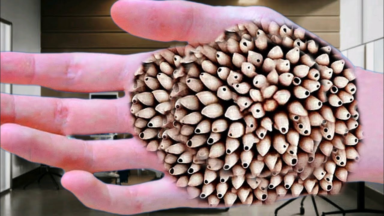 ASMR Severely Removal Maggot Infected Hand || ASMR Hand Treatment || 2d ...