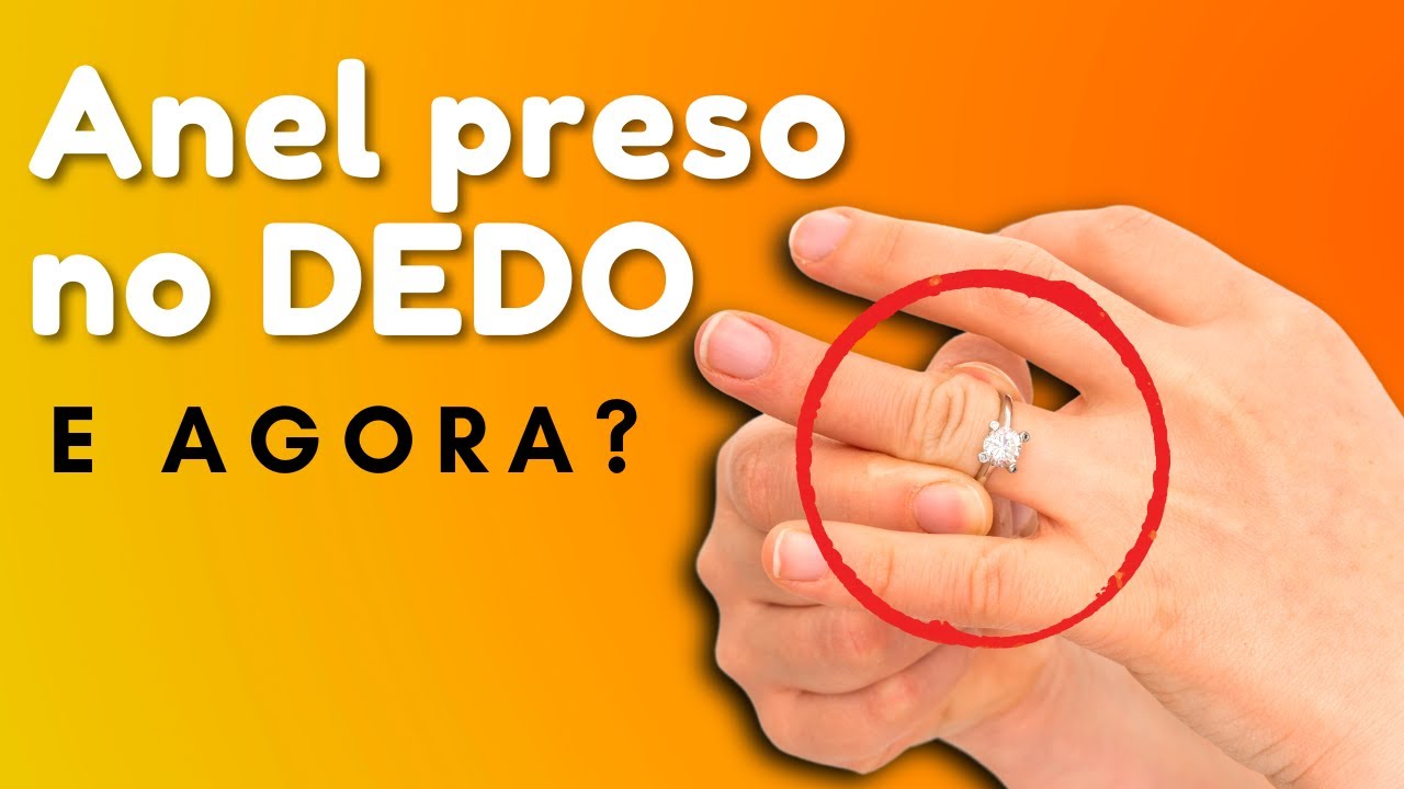 Como Tirar O Anel Do Dedo Inchado - lucox.cl