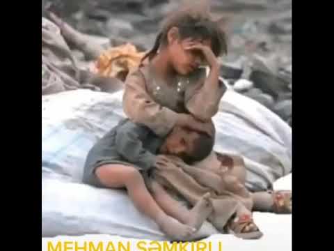 Xesdeyem yaraliyam qoymayin ölüm.😡