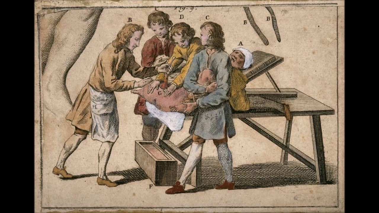 Marais: Le Tableau de l'Opération de la Taille. Coin, Hogwood - YouTube