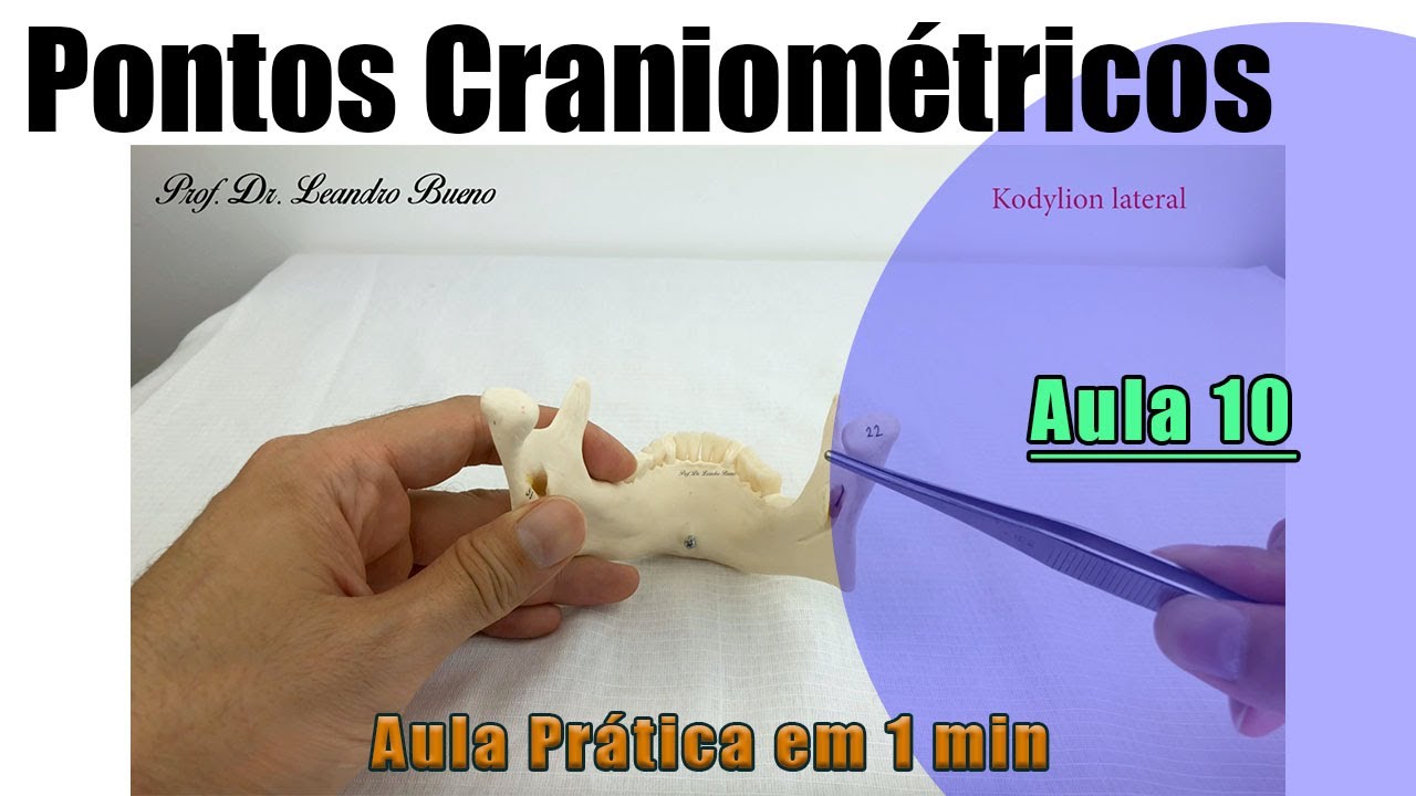 Pontos Craniométricos - Parte 10 - Prática - Anatomia Humana - YouTube