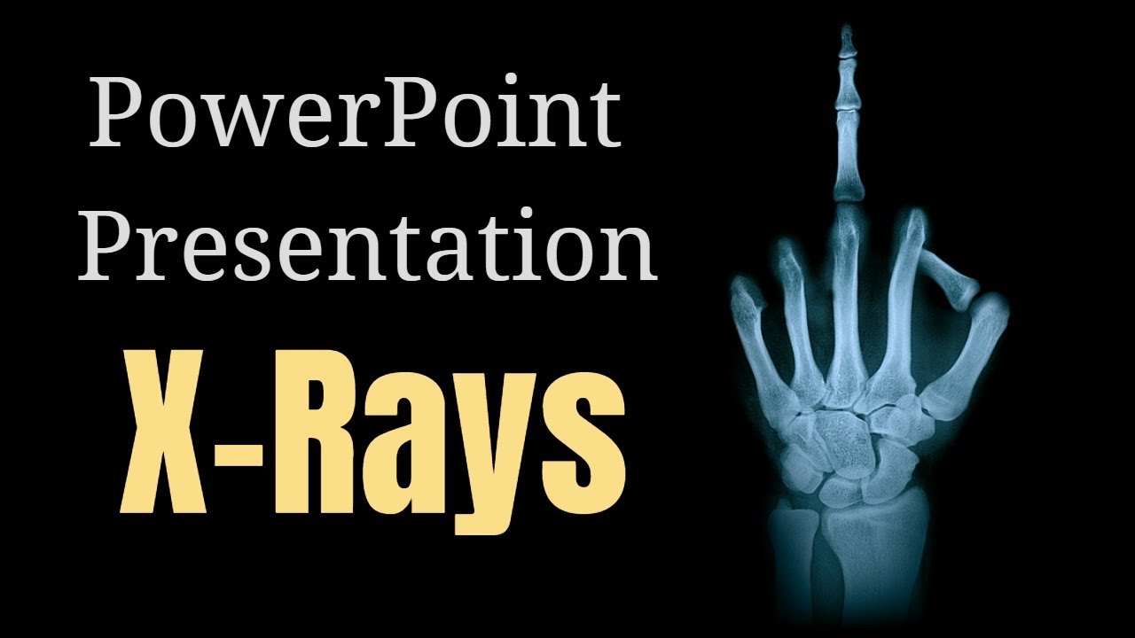 X Ray Ppt X Ray PowerPoint Presentation And Slides PPT Presentation