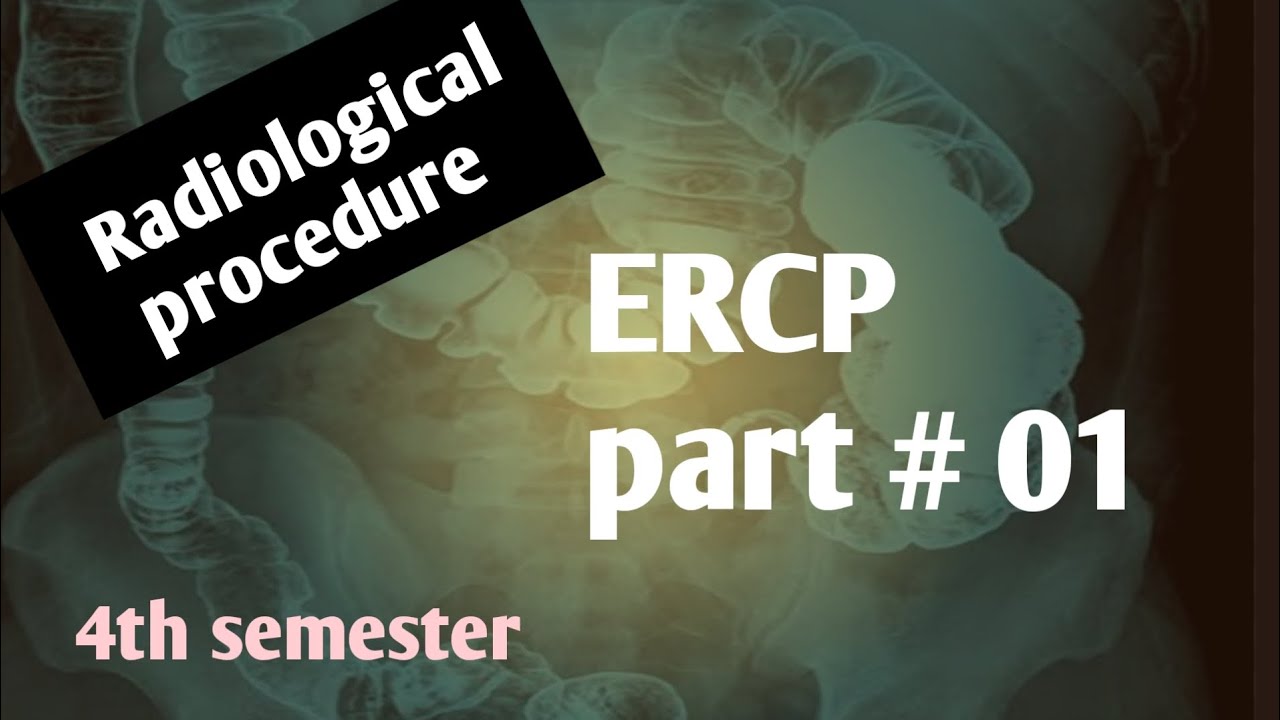 #endoscopic retrograde cholangiopancreatography/ERCP/part#01 ...