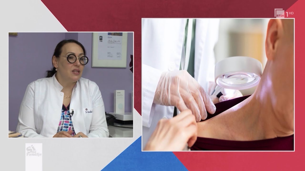 Sëmundjet autoimune të lëkurës dhe sa të rrezikshme janë ato | “Si në ...