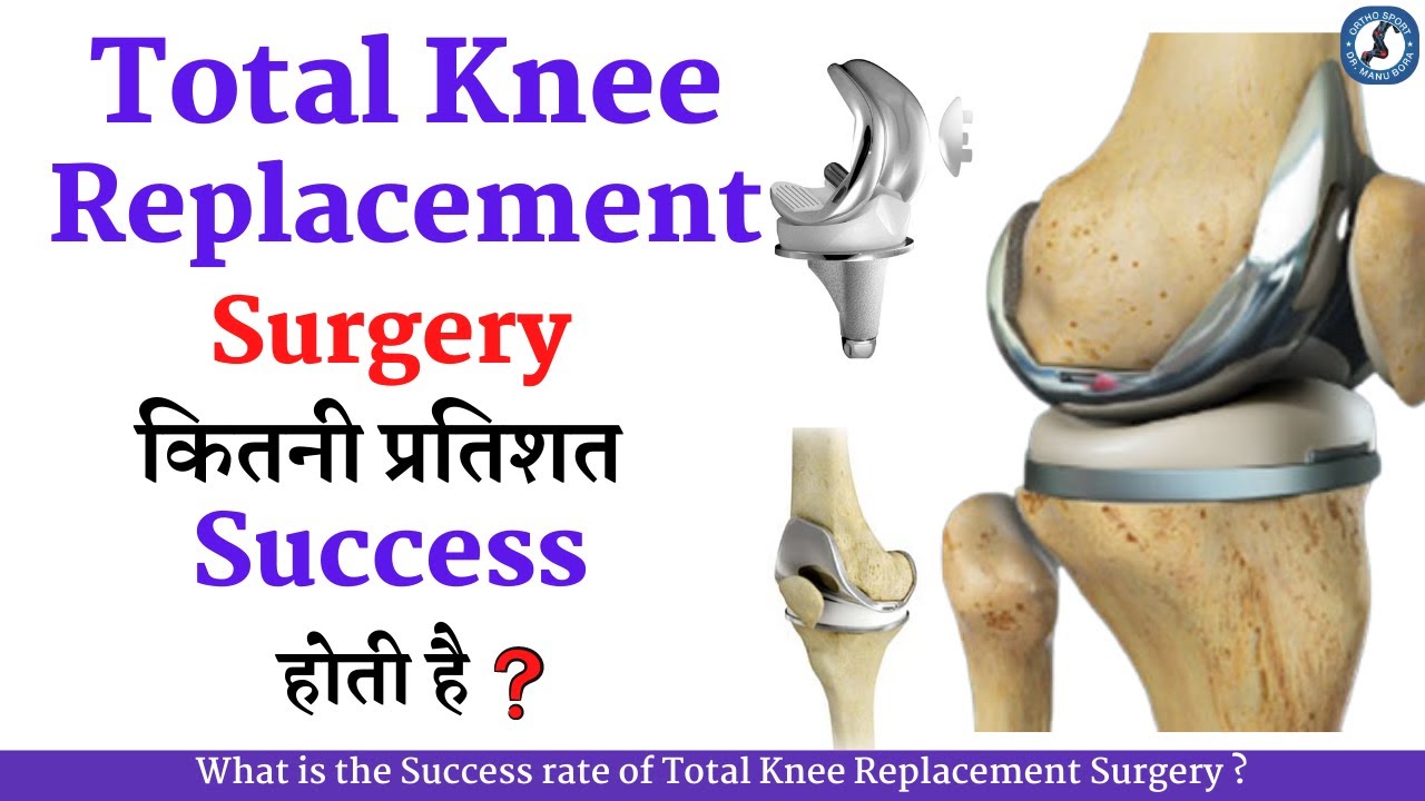 Total Knee Replacement Surgery कितनी प्रतिशत Success होती है ? #tkr # ...