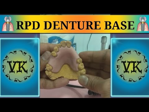 Dr VK's Dental Skool / Acrylic partial denture / RPD trial base ...