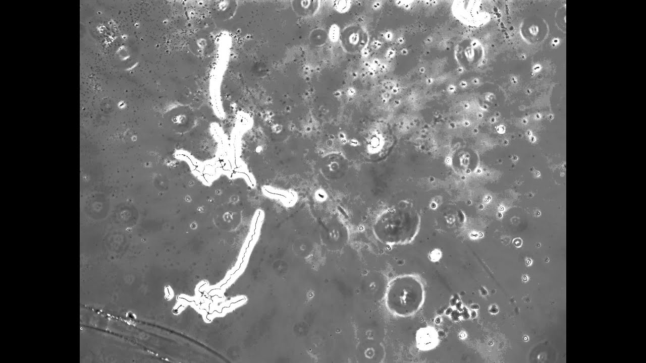 Anabaena Timelapse 21h 100x - YouTube