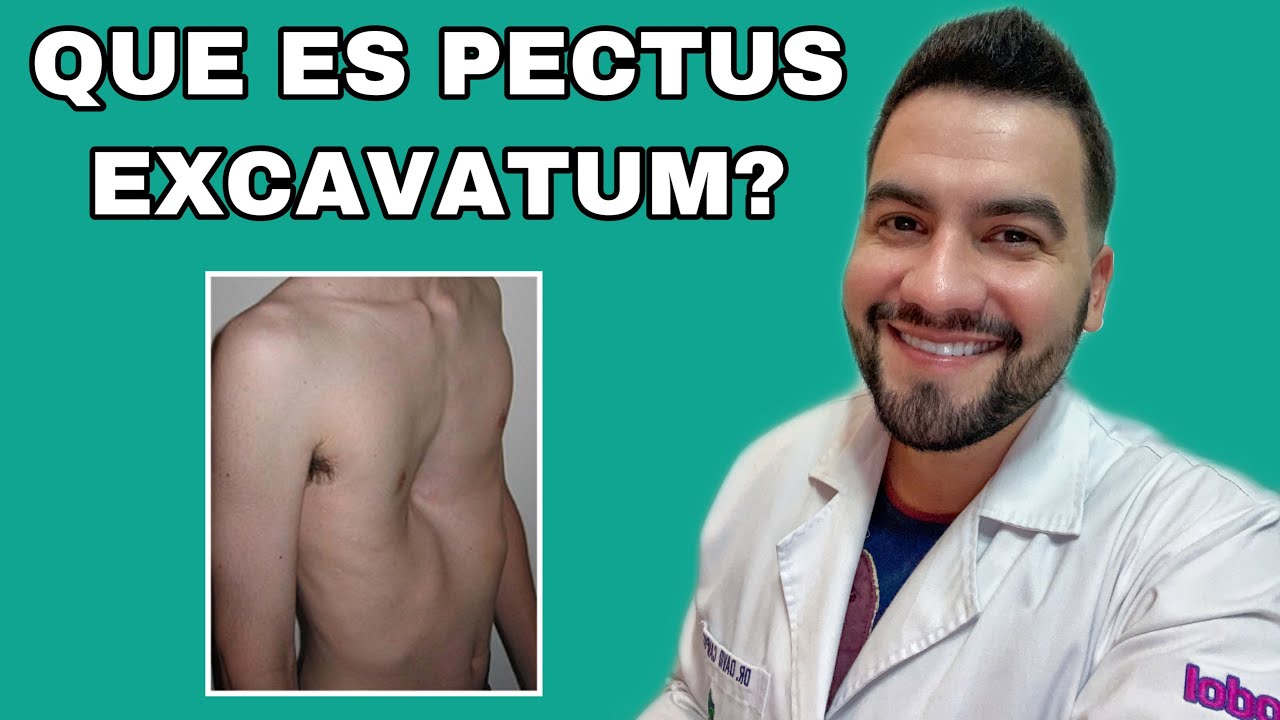 QUE ES PECTUS EXCAVATUM? / PECHO HUNDIDO | DR. DAVID CAMPOS - YouTube