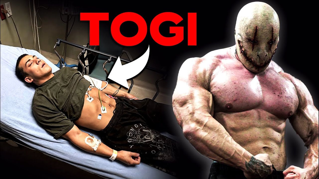 Watch Before You Start Steroids! - YouTube