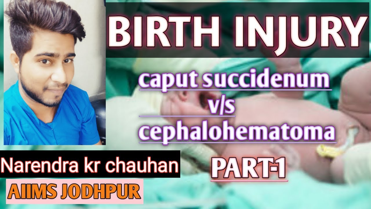 Birth injury (caput succidenum and cephalohematoma) - YouTube