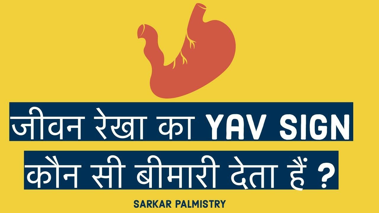 जीवन रेखा का Yav sign कौन सी बीमारी देता हैं? yav sign, yav sign on ...