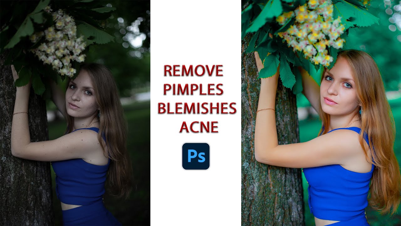Remove pimples Blemishes, Acne, Scars Easily and Quickly |Photoshop ...