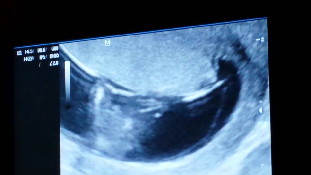 It's a boy...maybe - YouTube