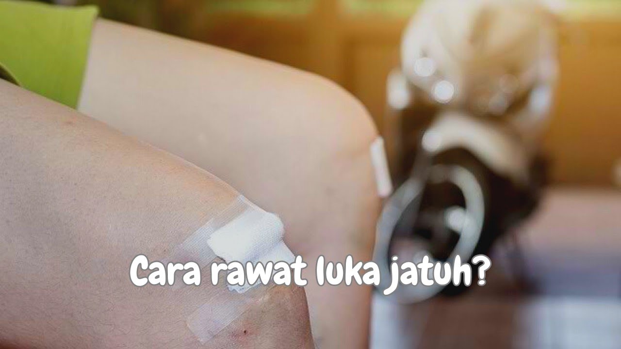 cara merawat luka jatuh dari motor - YouTube