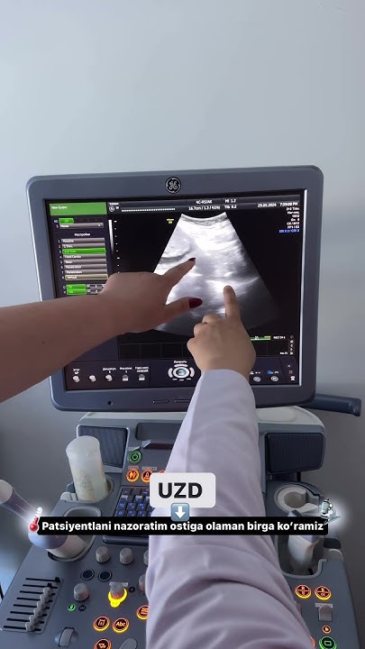 🔬 UZD tekshiruv jarayoni - YouTube