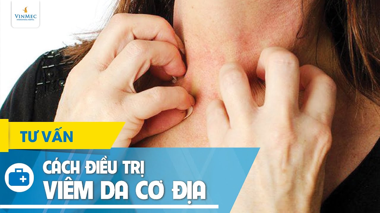 Cách điều trị viêm da cơ địa - YouTube