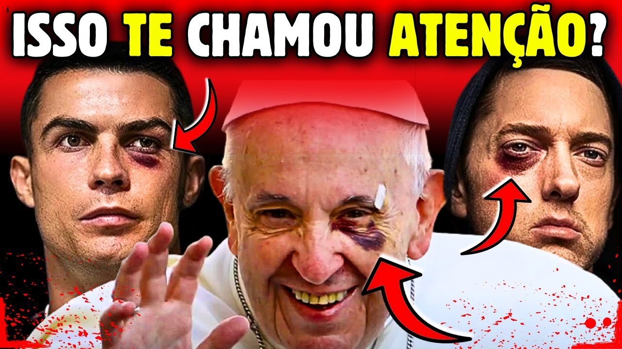 👁️PAPA FRANCISCO! 👁️O QUE ESTÁ POR TRÁS DO OLHO ROXO DOS FAMOSOS🤔Algo ...
