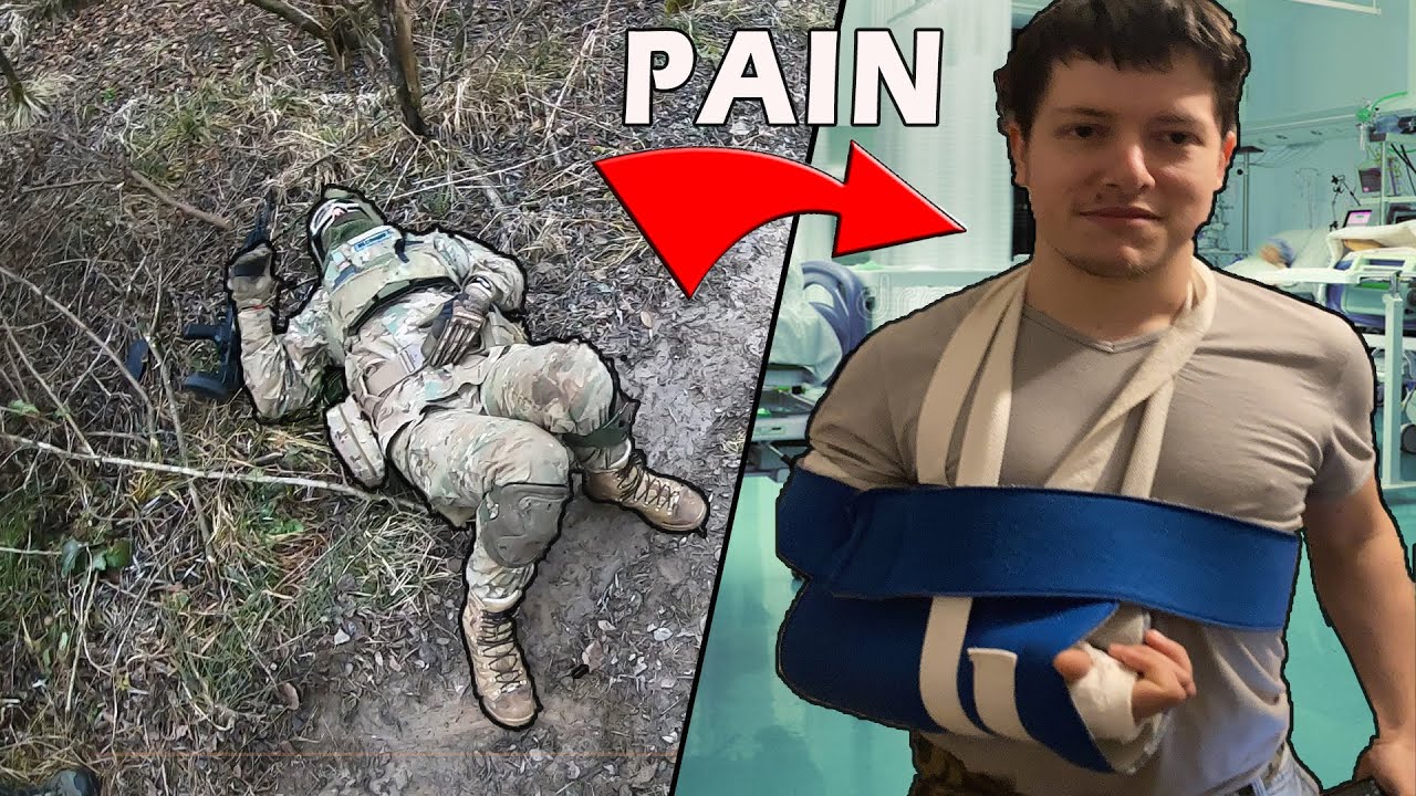 Airsoft INGURY during GAMEPLAY! [ BROKEN ARM ] - YouTube