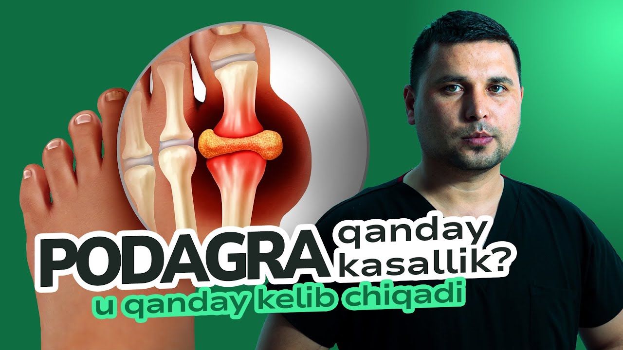 Podagra qanday kasallik - YouTube