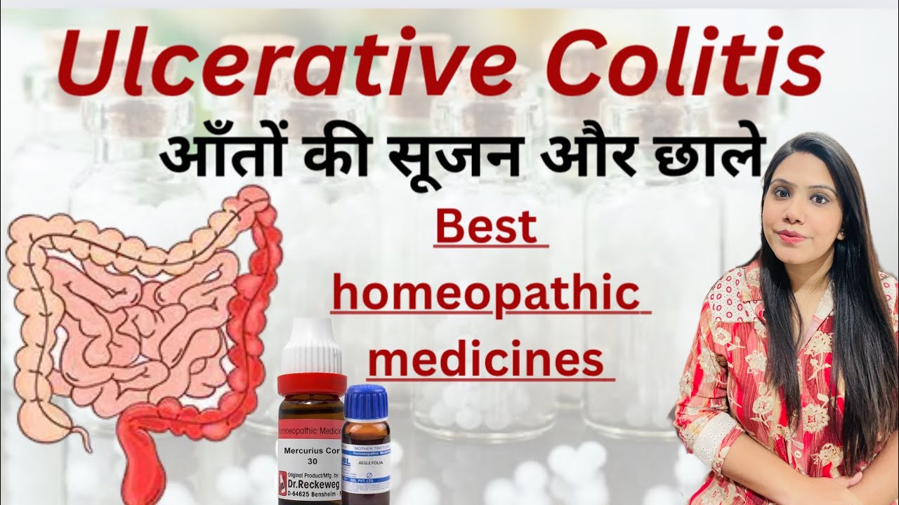 Ulcerative Colitis ||आँतों में सूजन || Homeopathic treatment in hindi # ...