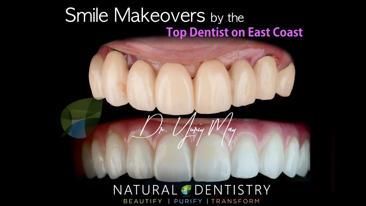 Natural Smile Makeovers From Best Cosmetic Dentist Usa Dr May