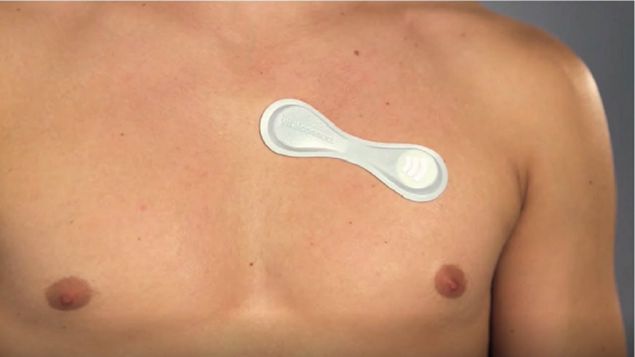 MBS HealthStream Remote Monitoring - YouTube