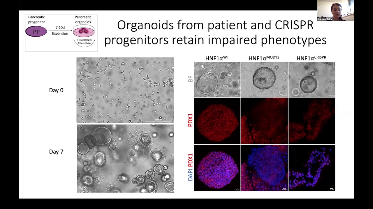 LSCN 2020: Ana-Maria Cujba – Kings College London - YouTube