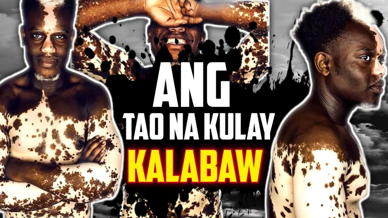 Ang TAONG may katulad sa BALAT ng KALABAW - YouTube
