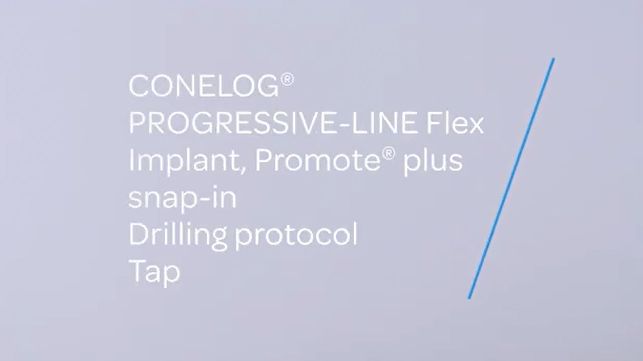CONELOG PROGRESSIVE-LINE Flex Implantate, Promote plus gesteckt ...