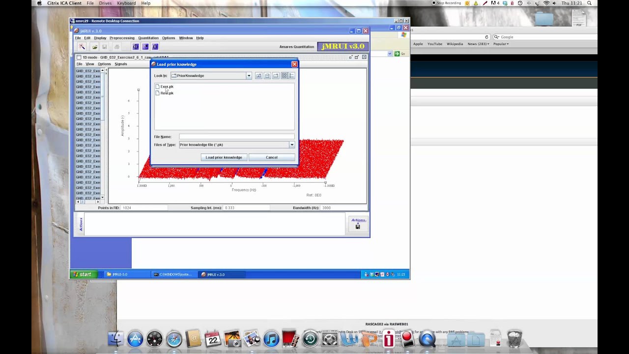 JMRUI processing for 31P-MRS data - YouTube
