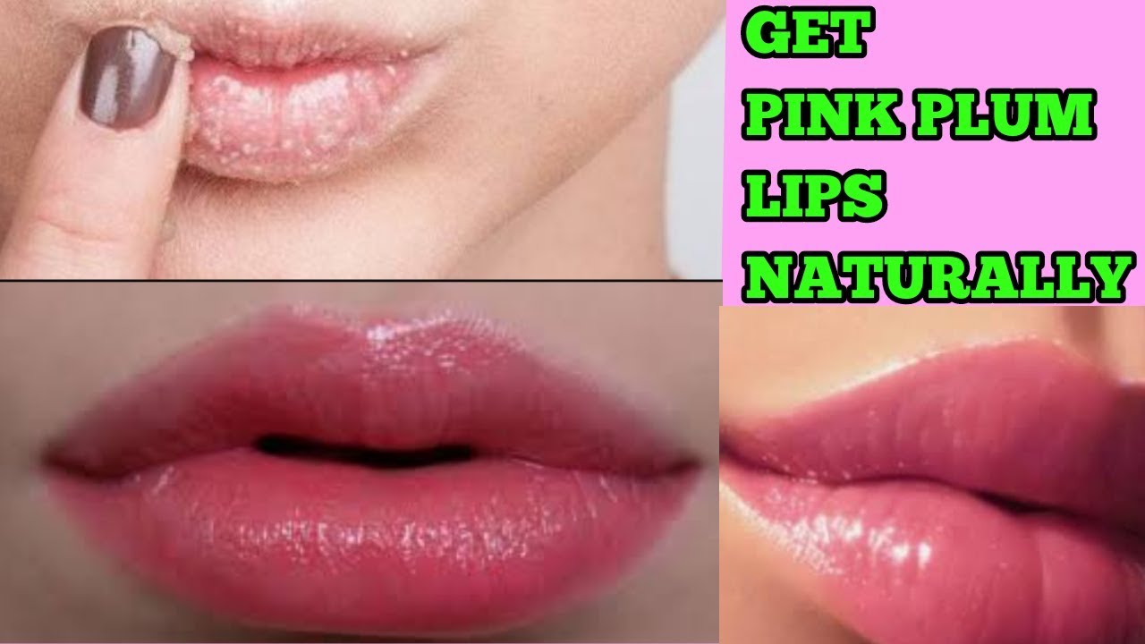 Get Pink Lips Naturally remove Dead Skin Cells On Lips The CharmGirl get-pink-lips-naturally-remove-dead-skin-cells-on-lips-the-charmgirl