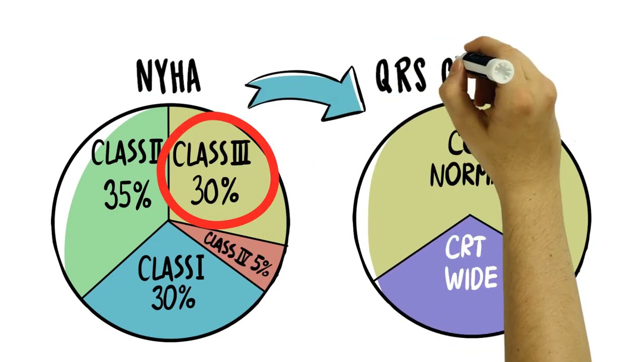 CCM Therapy Explainer Animation (CE Mark Indications) - YouTube