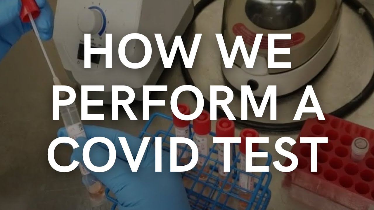 How We Perform a COVID Test at Microbix Biosystems Inc. - YouTube