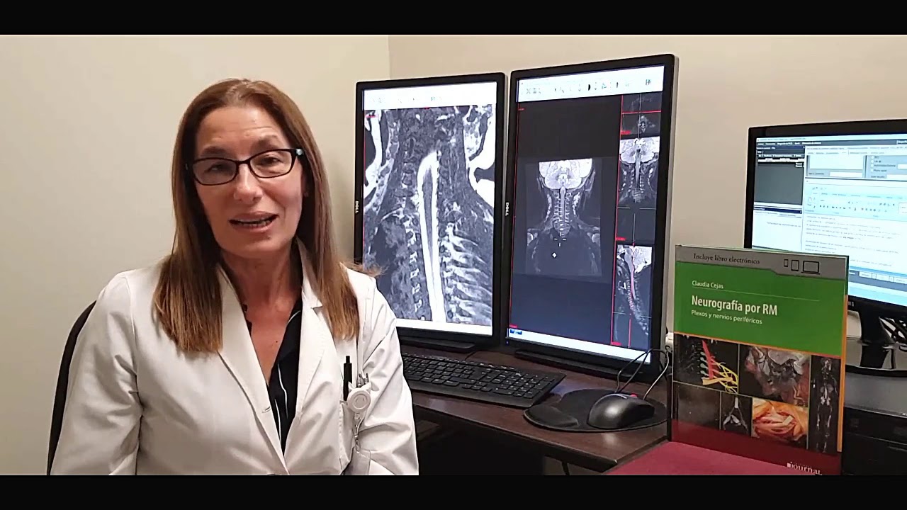 Neurografía por RM - YouTube