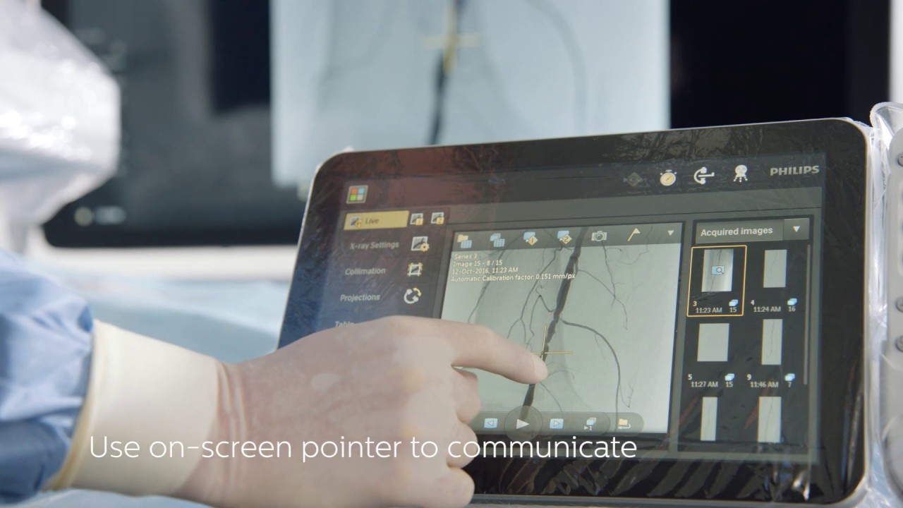 Philips Azurion touch screen module Pro - YouTube