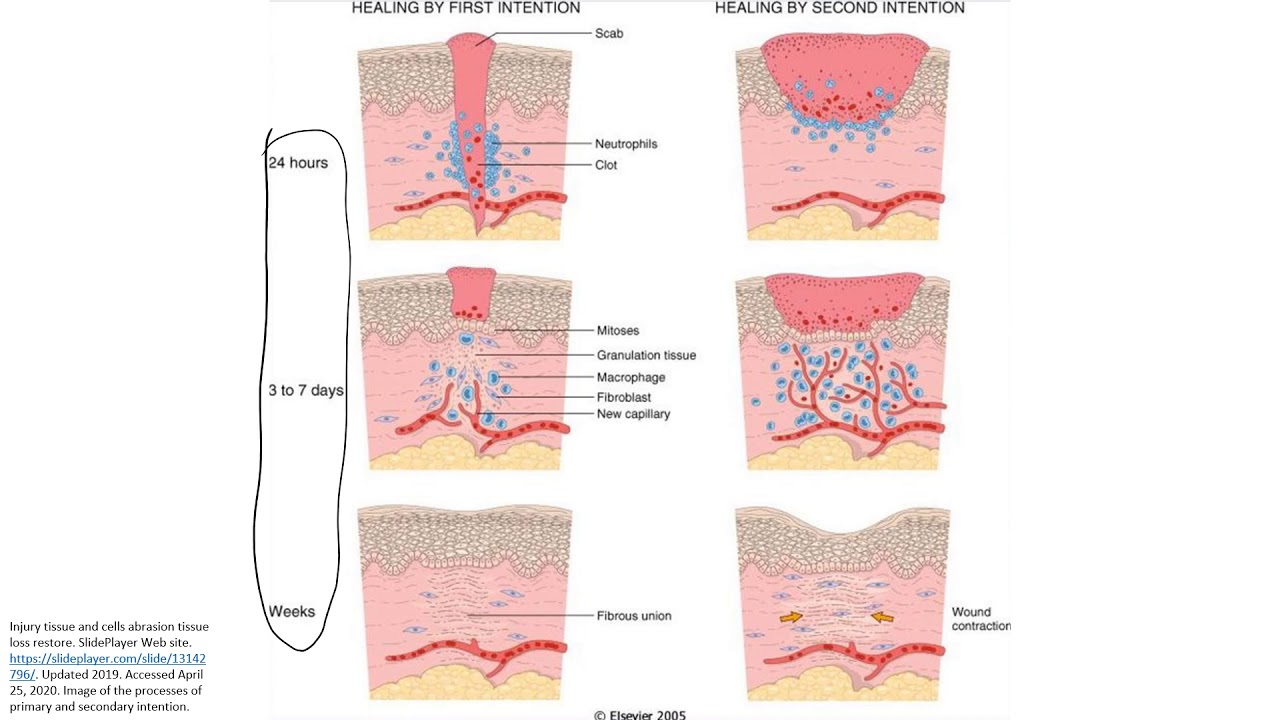 Types of Tissues and Healing Processes - YouTube